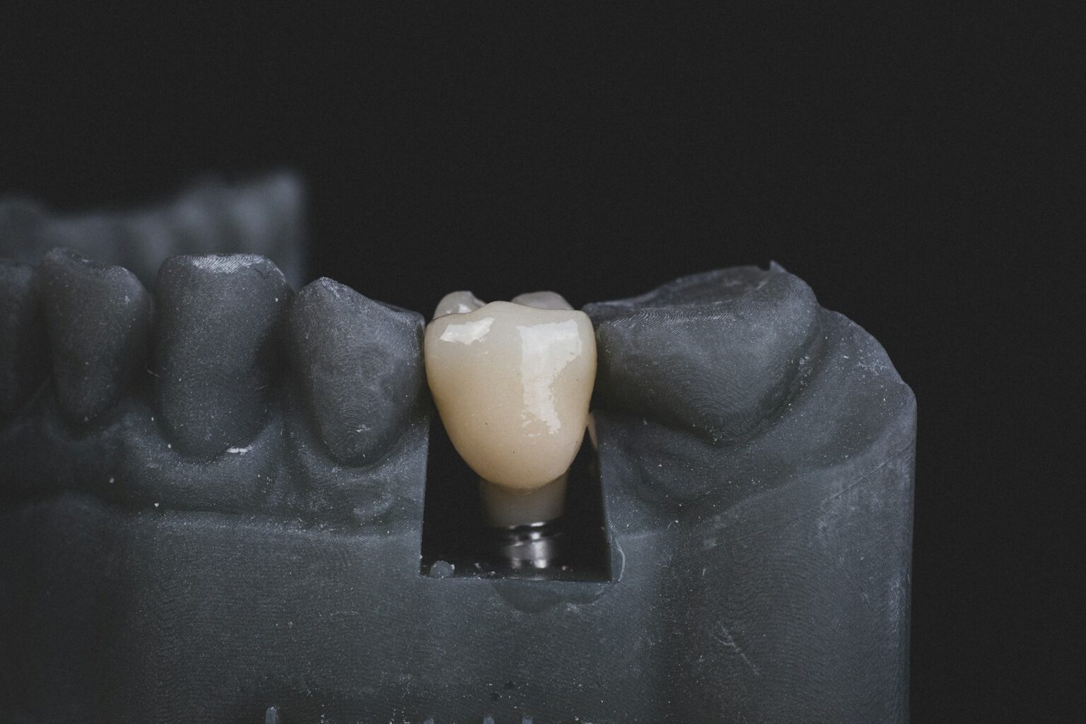 Dental Crown Process: Complete Breakdown for a Perfect Fit